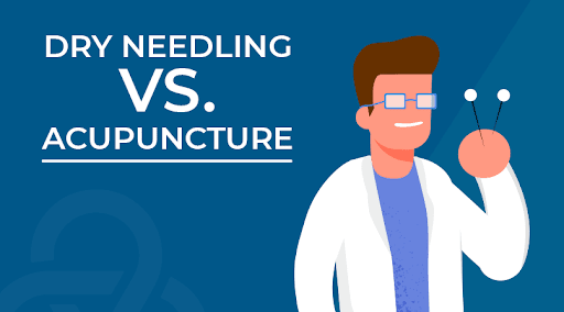 Dry Needling vs Acupuncture: The Comprehensive Guide